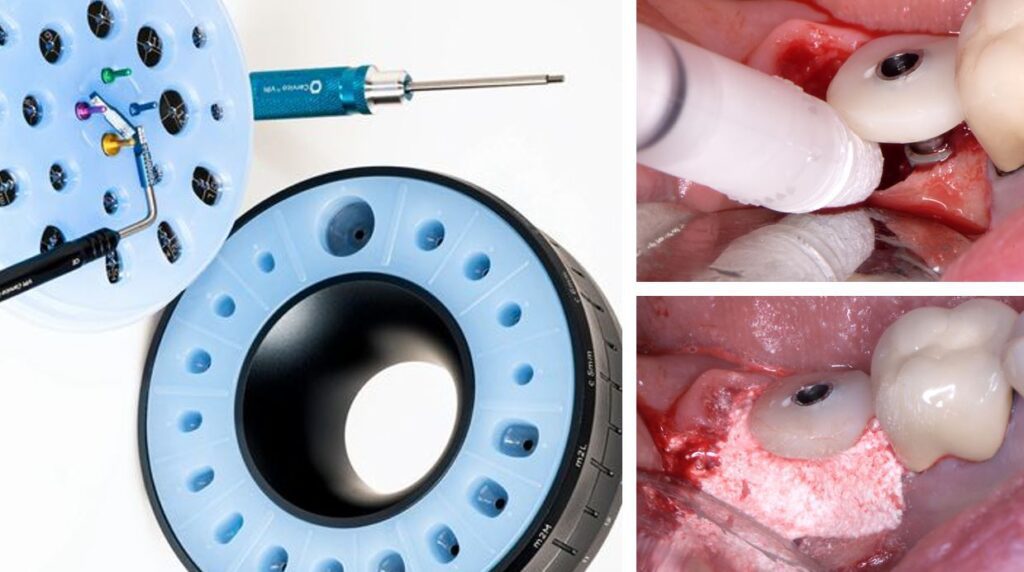 Surgical Kit for TopDM and DM Plus Dental Implant. | Restore Surgical