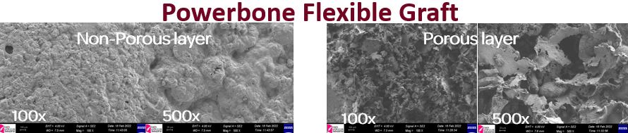 Powerbone Flexible Synthetic Matrix For Ridge Augmentations.
