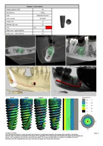 Guided Digital Plan and 3d Surgical Guide | Restore Surgical
