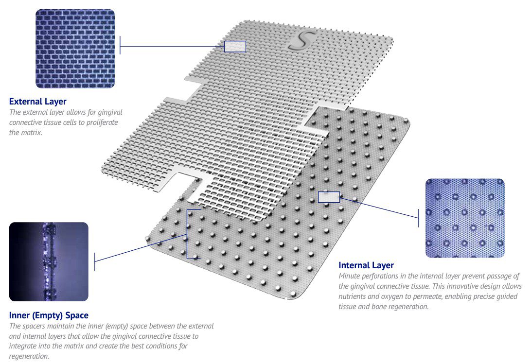 Dental Membranes | Restore Surgical